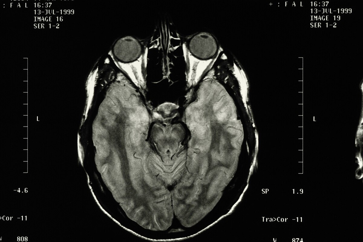 Neurowissenschaft: Kreativität kann dabei helfen, besser mit Schmerz ...